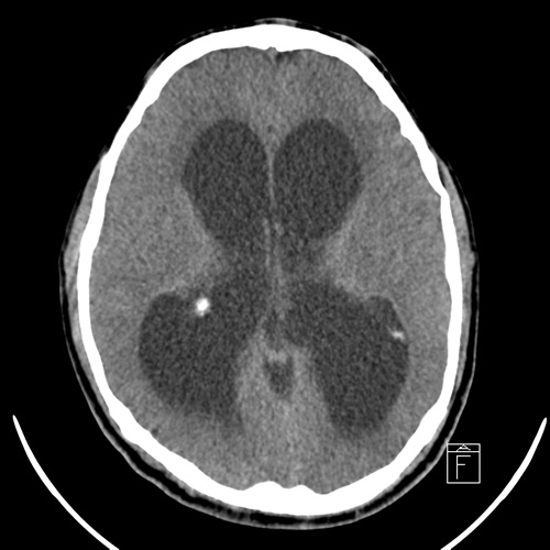 Projects - Armin Abdollahi